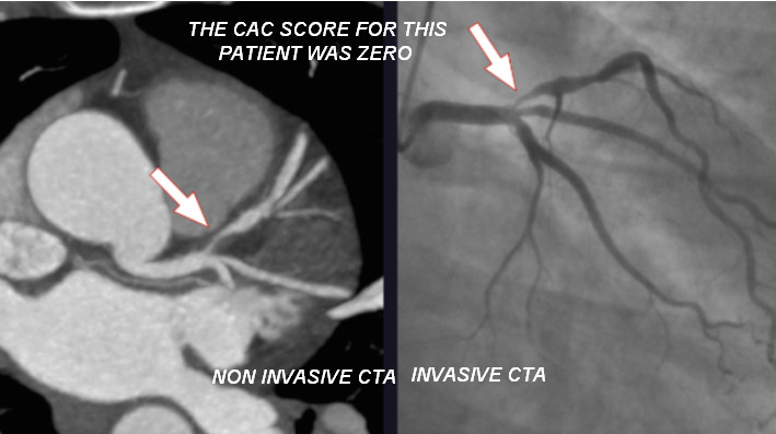 Heart Attack City.Org